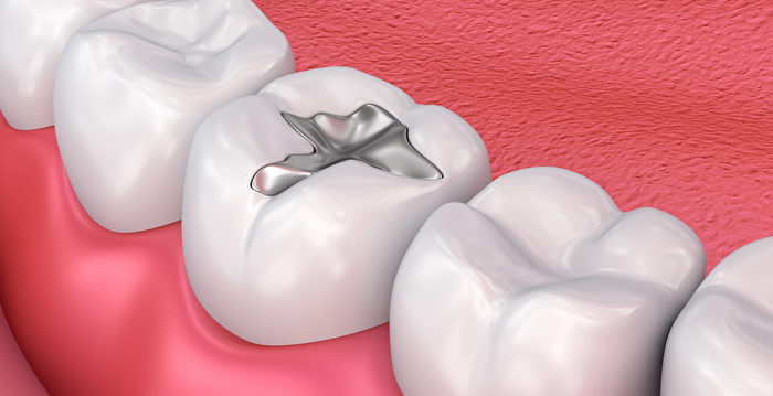 以後可能不需要補牙了！研究：牙能借力再生 | Tideglusib | 牙齒修復 | 牙齒再生 | 大紀元